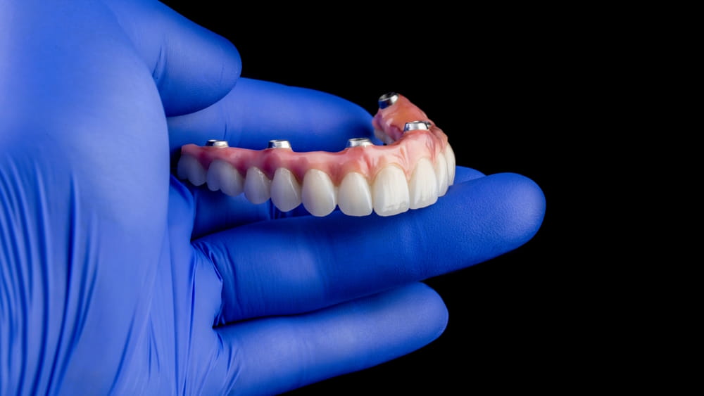Prótese dentária — Simas Odontologia